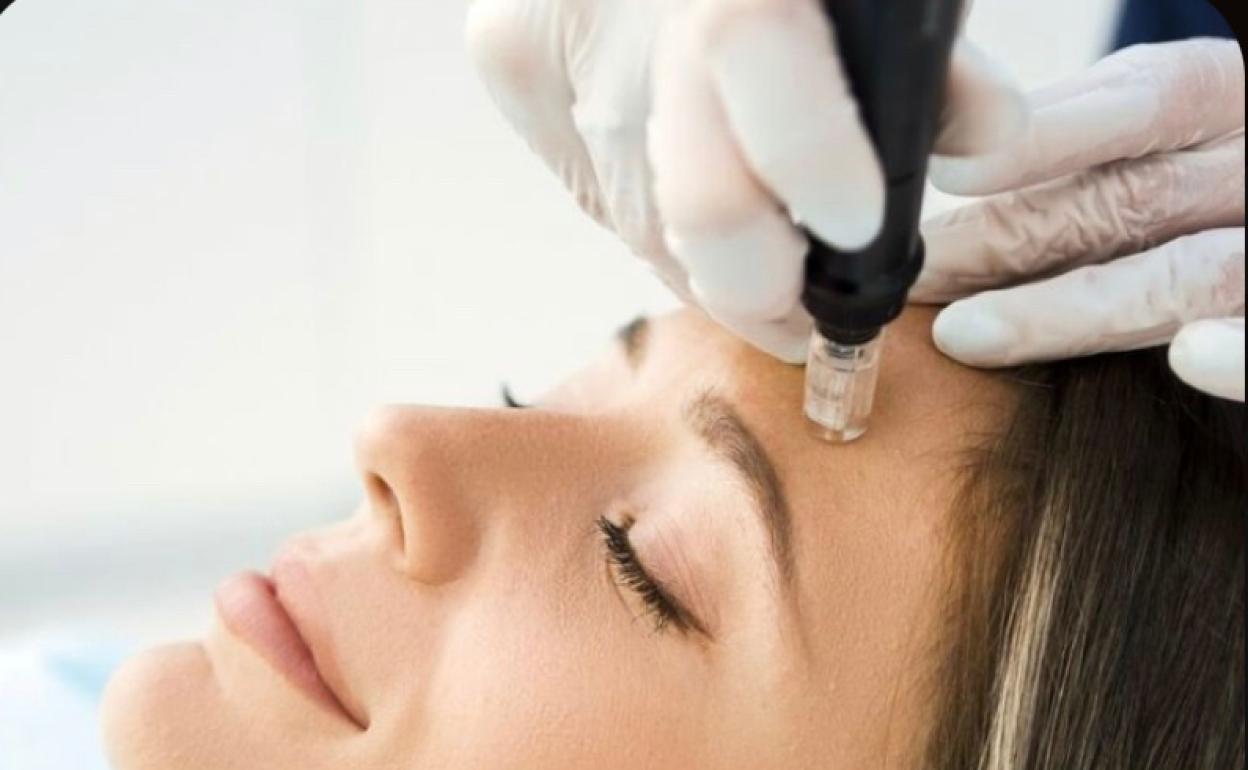 'Microneedling' qué es y por qué tengo que saber qué hace | El Diario Vasco